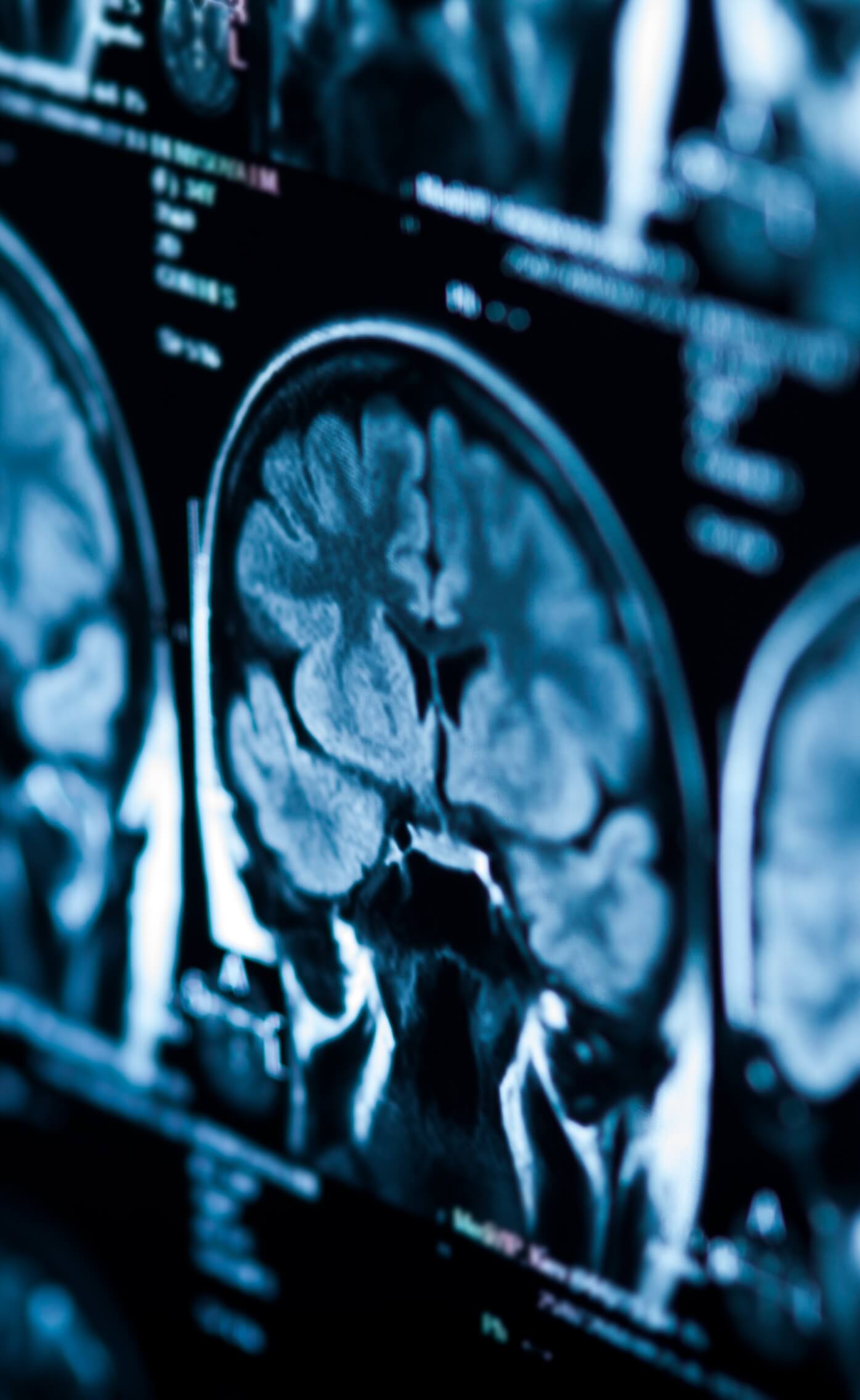 Kineticos Portfolio | neuro42